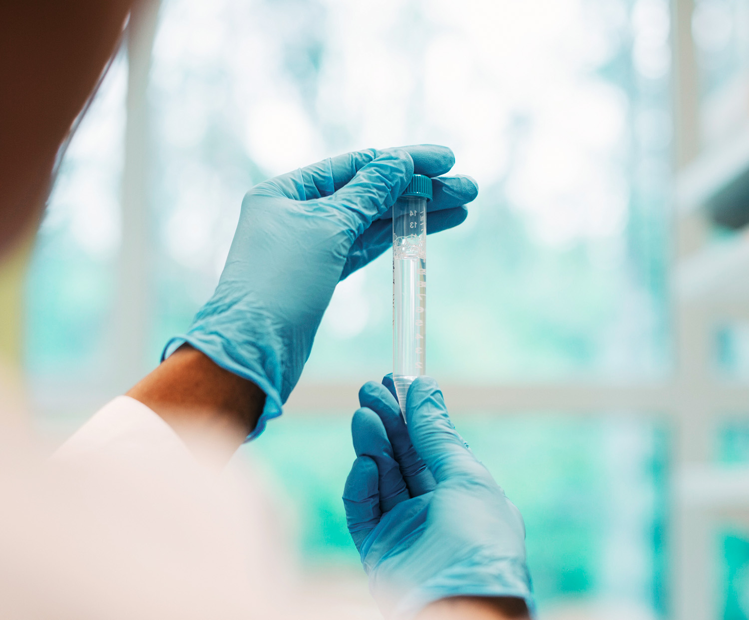 細胞・検体保管サービス-CryogenicArchives-｜NXワンビシアーカイブズ